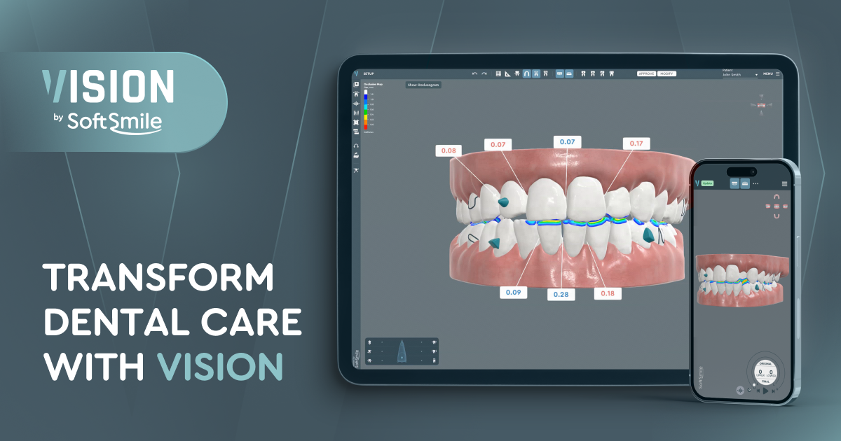 Aligners | SoftSmile
