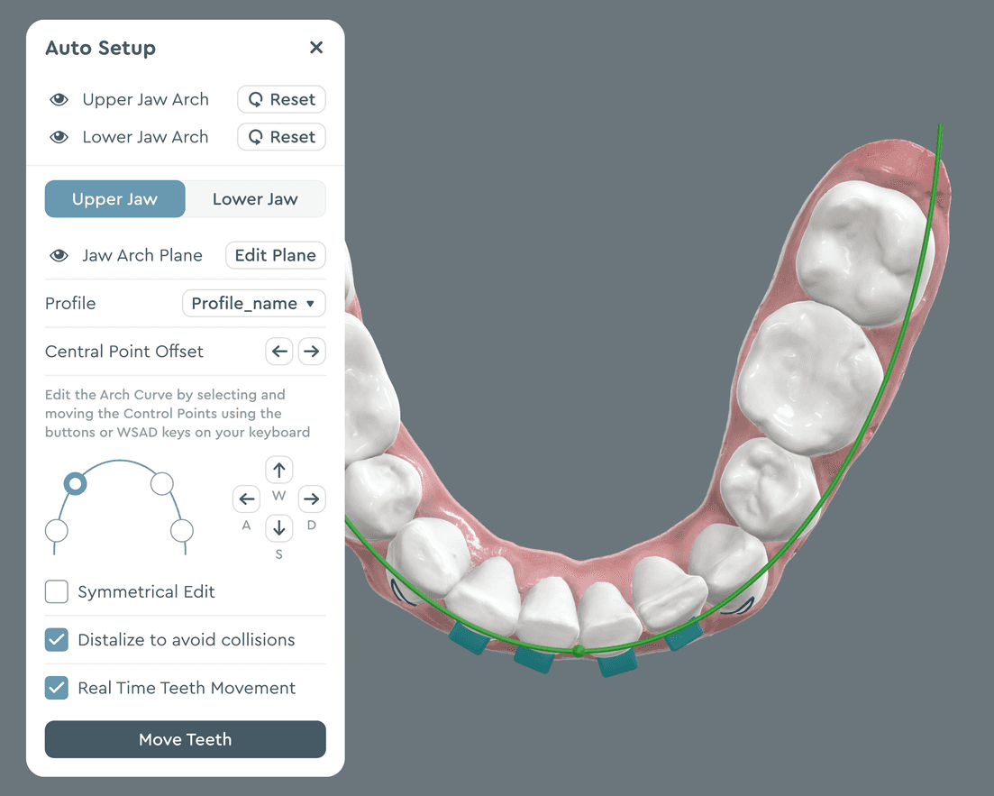 Clear Aligner Design Service | SoftSmile