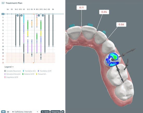 Dental Software Features | SoftSmile