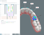 Orthodontic Aligner Design Software — SoftSmile