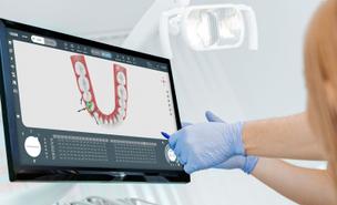 AI Dental Treatment Planning
