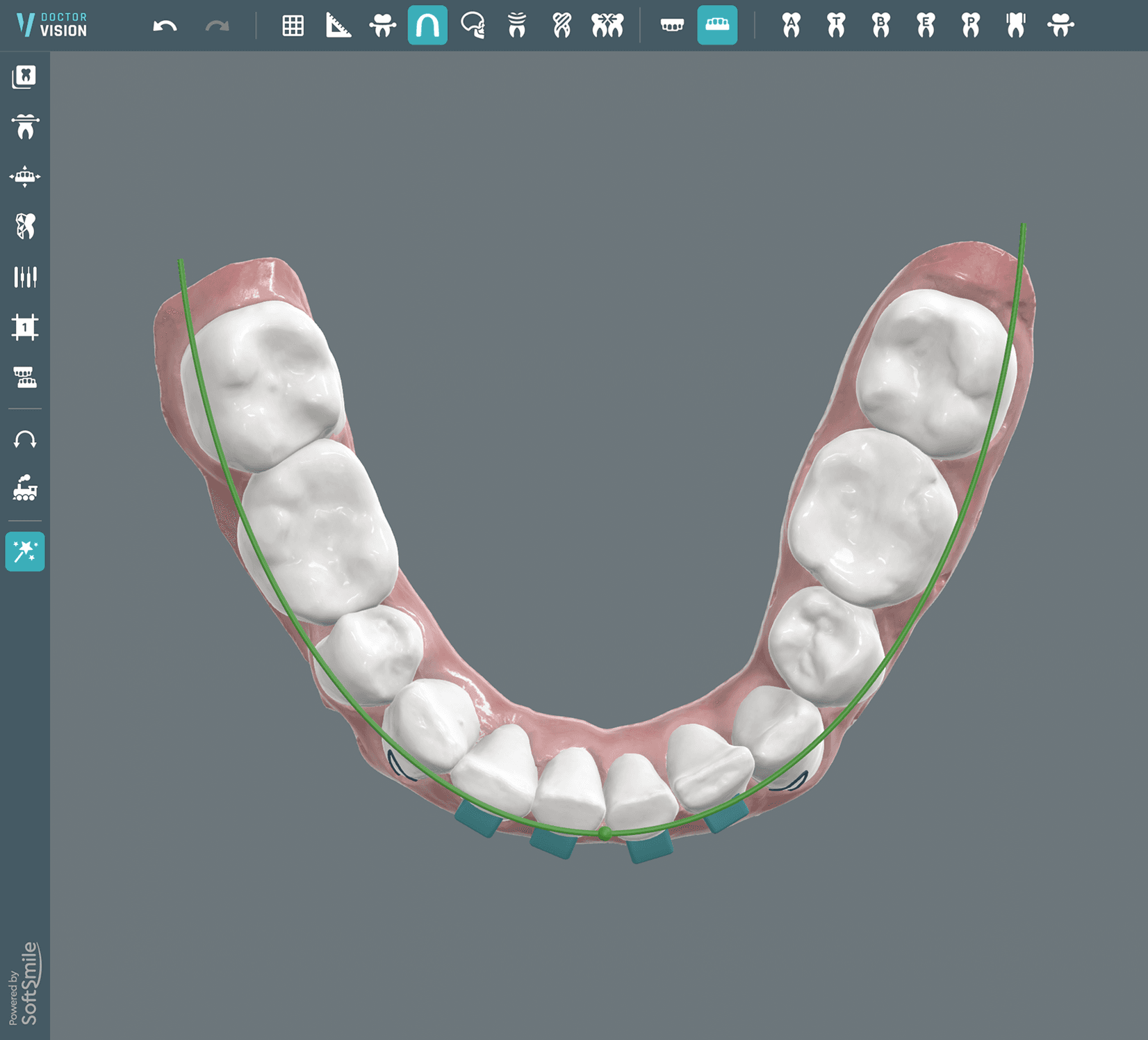 Orthodontic Software — Dr. Vision