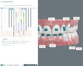 Dental Software Features | SoftSmile