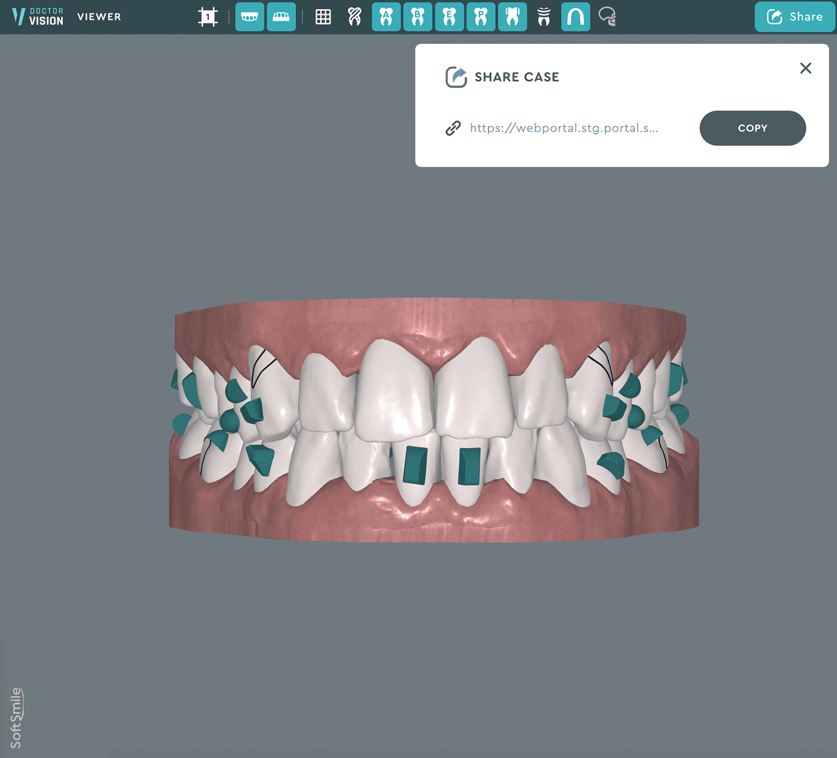 Orthodontic Software — Dr. Vision