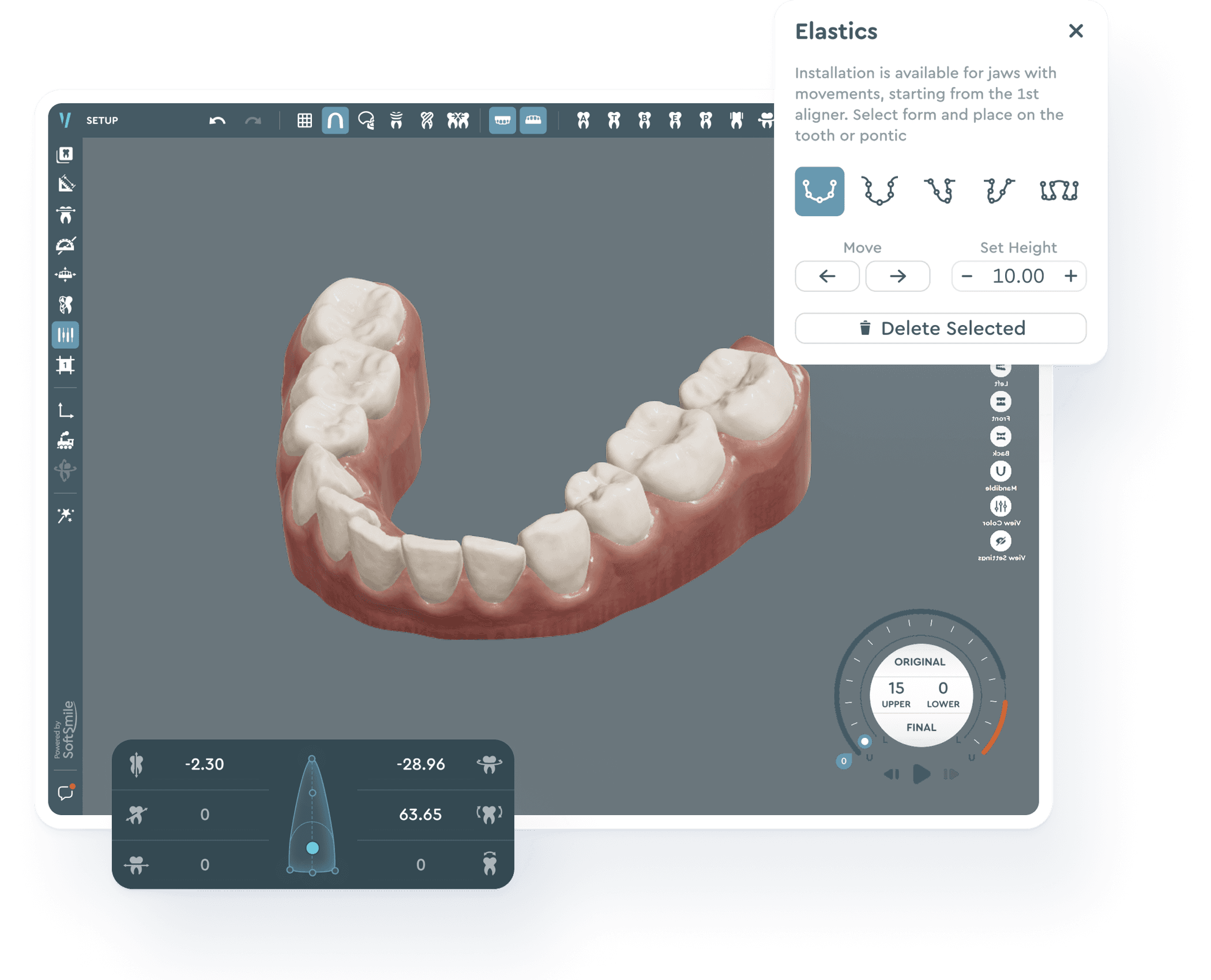 Dental Software Features | SoftSmile
