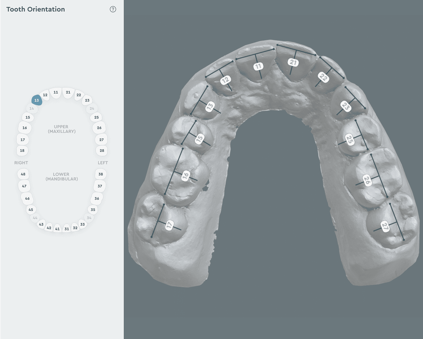 Orthodontic Aligner Design Software — SoftSmile